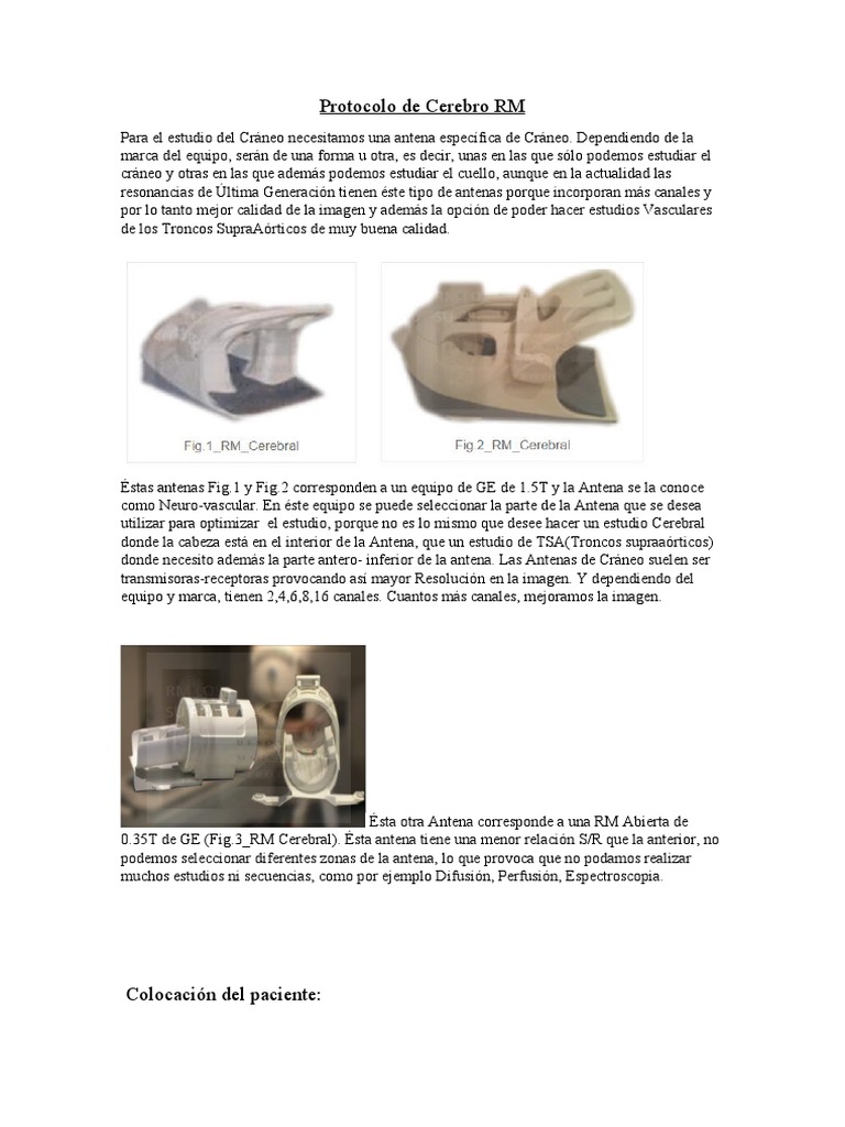 Protocolo de Cerebro RM | PDF | Cerebro | Antena (Radio)