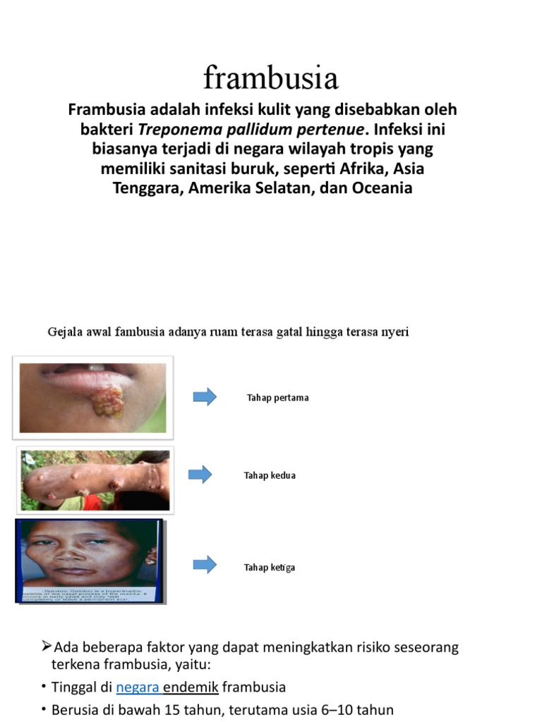 Risiko dan Gejala Frambusia | PDF