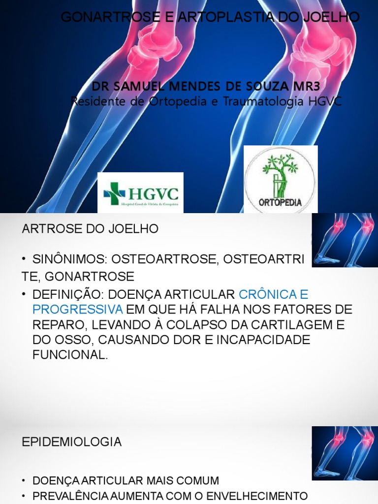 Gonartrose e Artoplastia Do Joelho | PDF | Osteoartrite | Joelho
