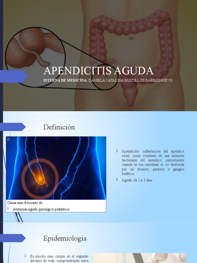 Apendicitis Aguda 1 | PDF