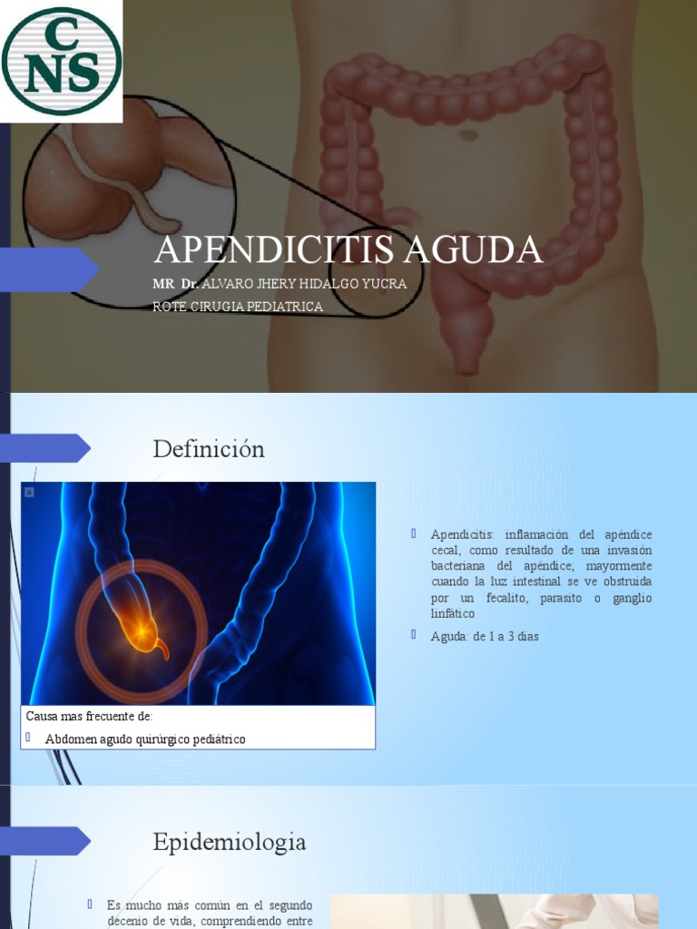Apendicitis Aguda Pediatria | PDF | Enfermedades y trastornos humanos | Enfermedades digestivas