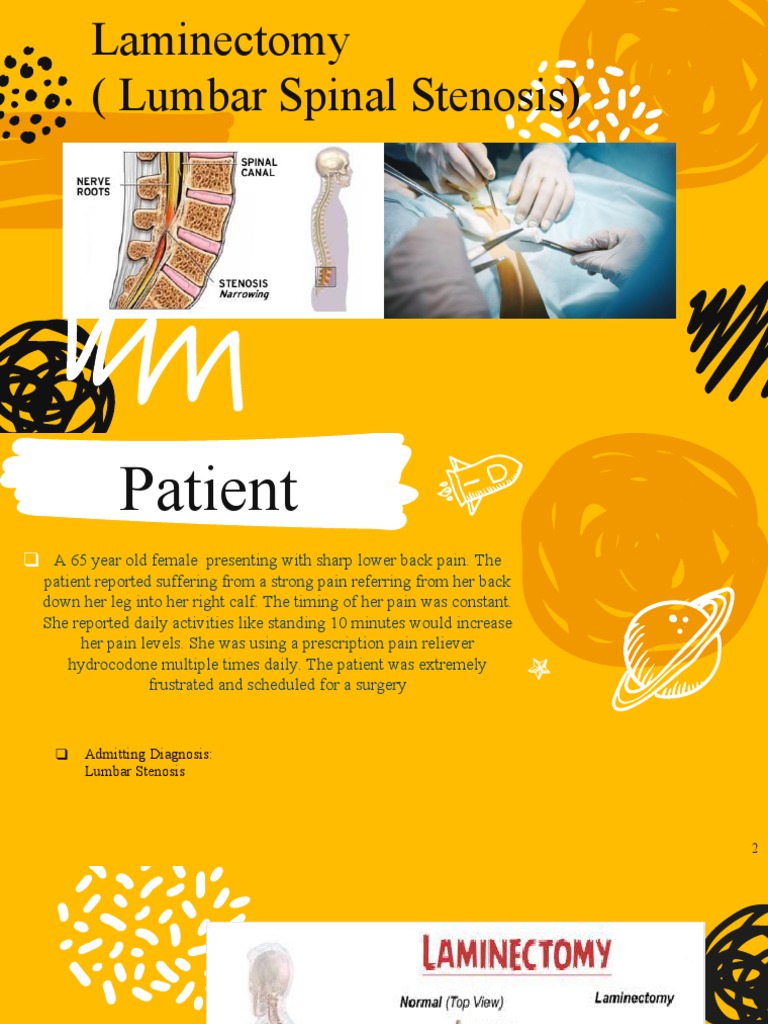 Laminectomy | PDF | Vertebral Column | Spinal Cord