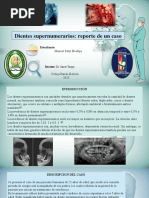 Dientes Supernumerarios: Diagnóstico y Extracción | PDF | Diente ...