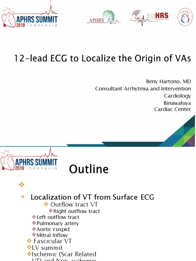 ECG To Localize VA | PDF | Electrocardiography | Thorax (Human Anatomy)