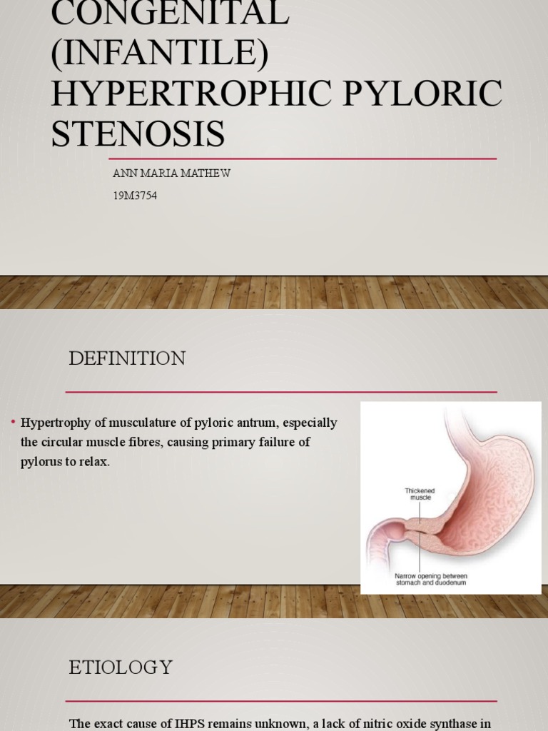 Surgery Sem- Cong Hypertrophic Pyloric Stenosis | PDF ...