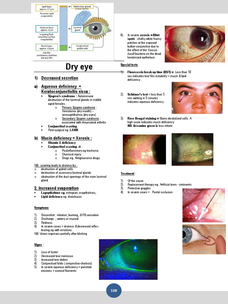 Dry Eye | PDF | Medical Specialties | Human Diseases And Disorders
