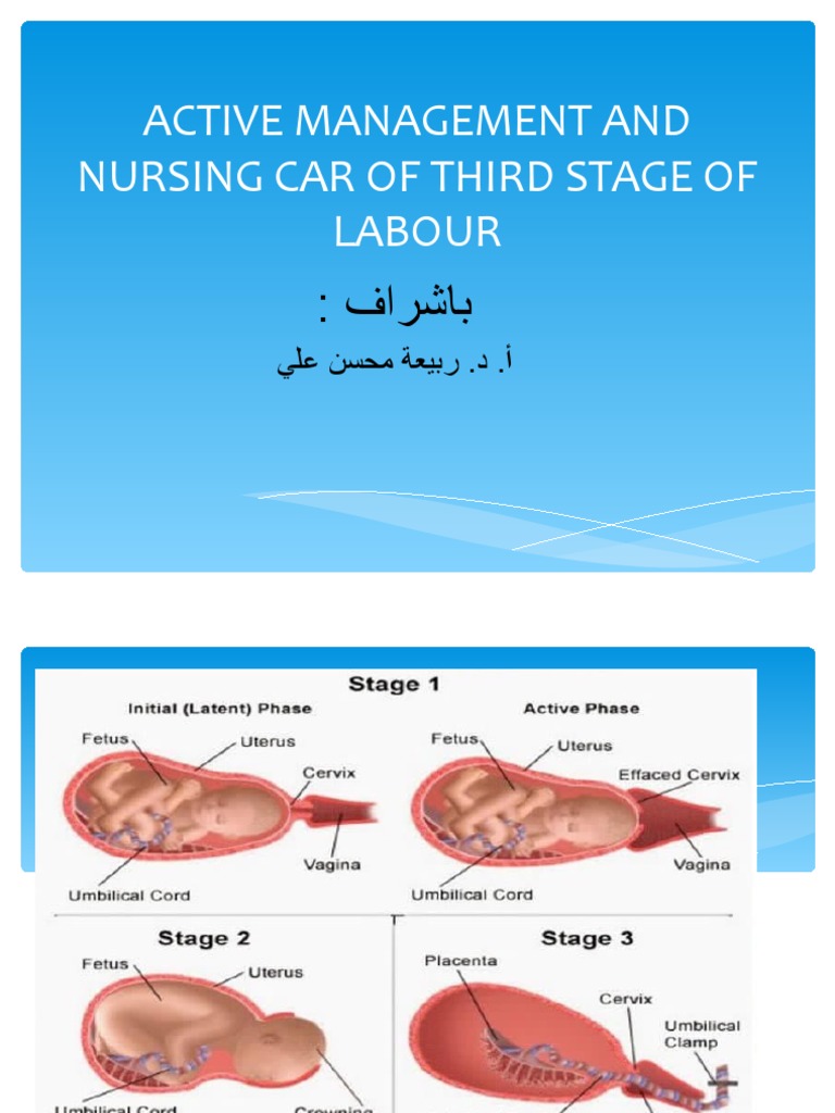 Active Management of Third Stage of Labour | PDF | Uterus | Childbirth
