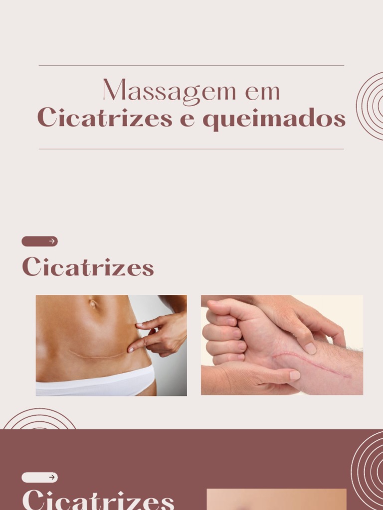 Massagem em Cicatrizes e Queimados | PDF