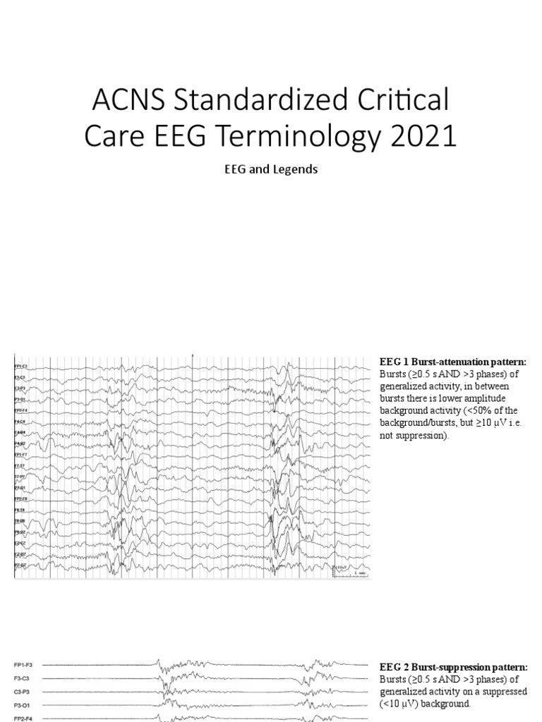 ACNS Standardized Critical Care EEG Examples 2021 | PDF ...