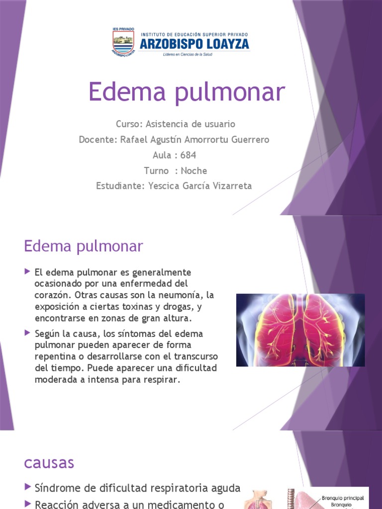 Causas y síntomas del edema pulmonar | PDF
