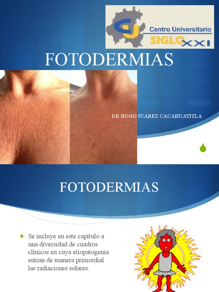Fotodermias | PDF