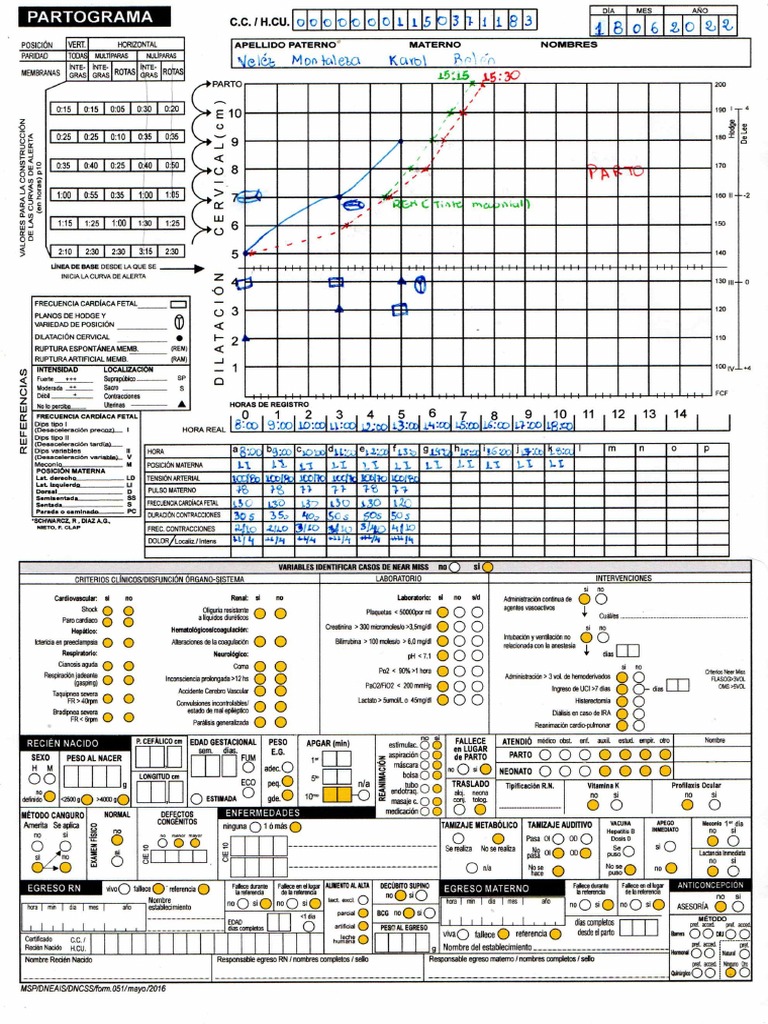 Partograma | PDF