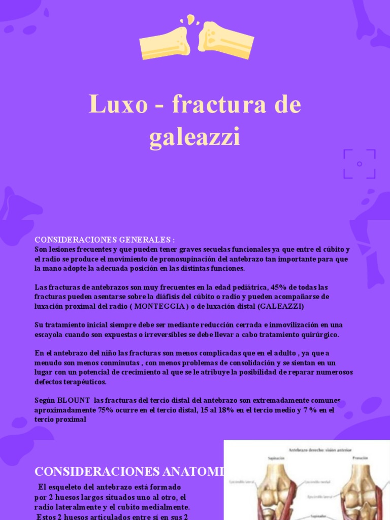 Fractura de Galeazzi: Diagnóstico y Tratamiento | PDF | Codo | Mano
