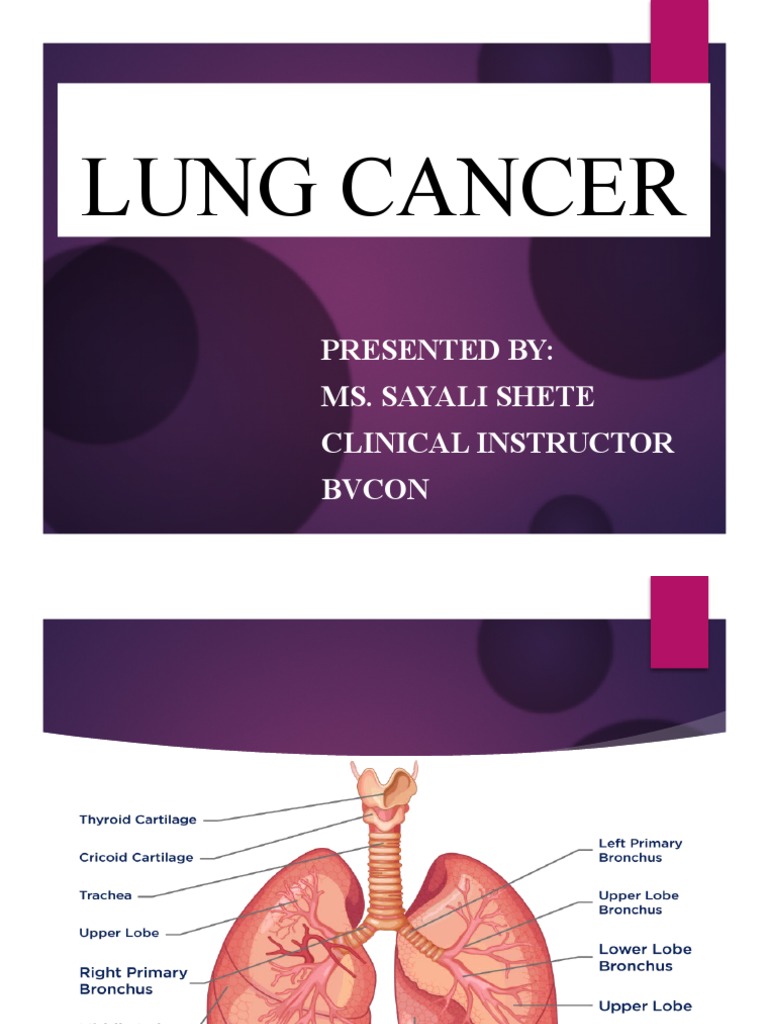 Lung Cancer | Download Free PDF | Lung Cancer | Cancer