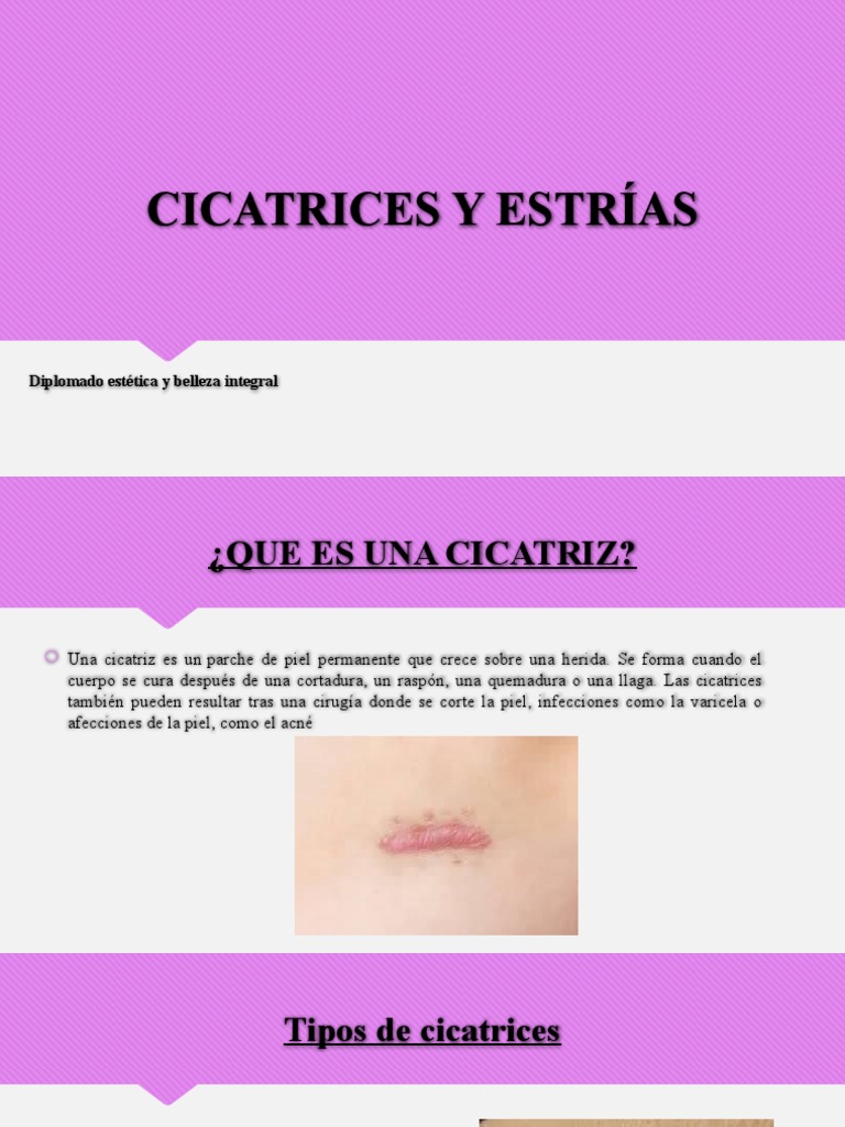 Cicatrices y Estrías | PDF | Cicatriz | Piel