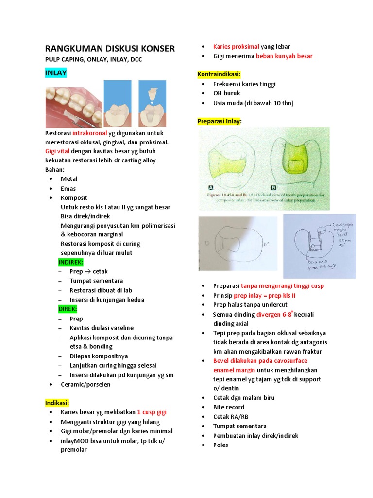 PC Onlay Inlay DCC | PDF