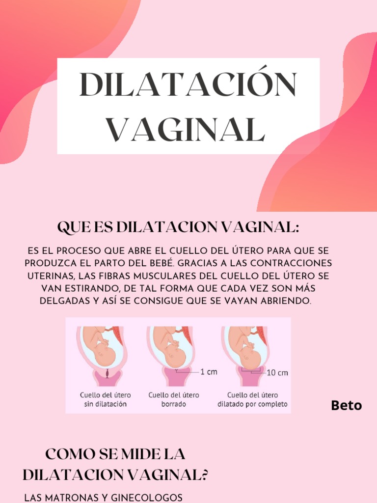 Dilatacion Vaginal | PDF | Parto | Embarazo Mamífero