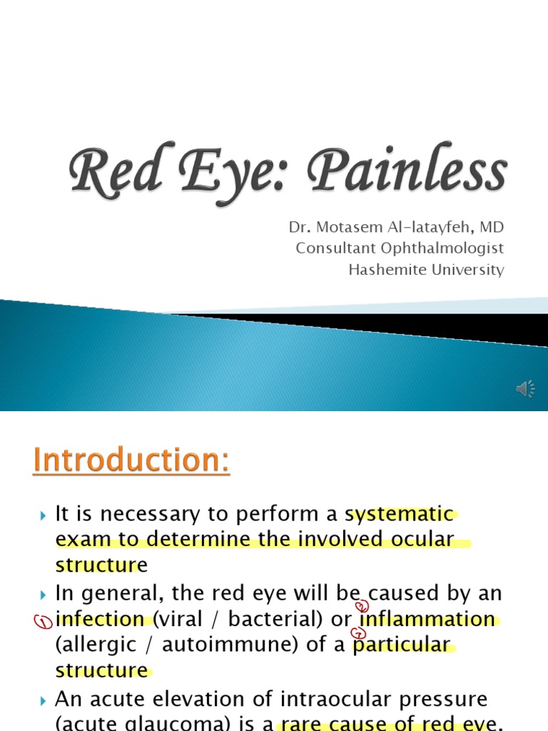 3-Painless Red Eye | PDF
