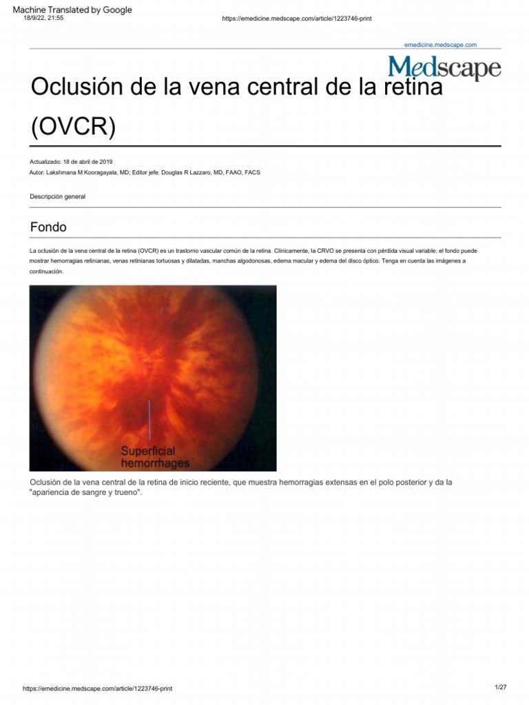 Oclusión de Vena Central de Retina | PDF | Ojo humano | Factor de ...
