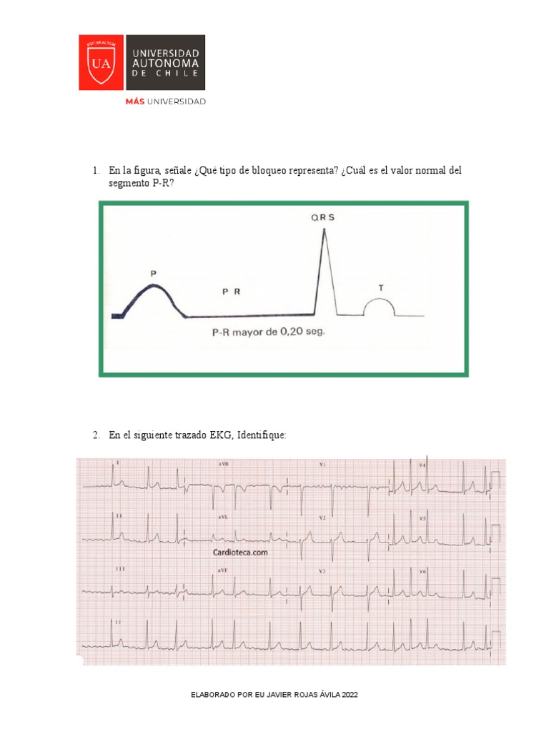 Taller Ekg | PDF