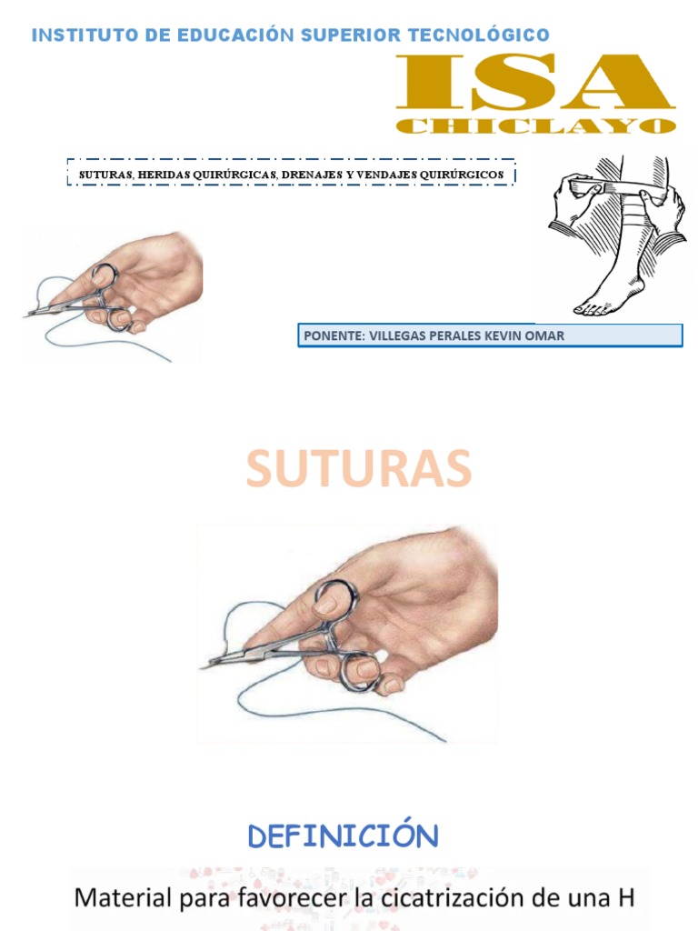 Sutura Quirúrgica: Tipos y Materiales | PDF