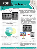 Planejamento Resto Radicular 16 | PDF | Anestesia | Especialidades médicas