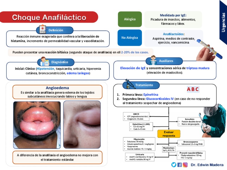 Choque Anafiláctico | PDF