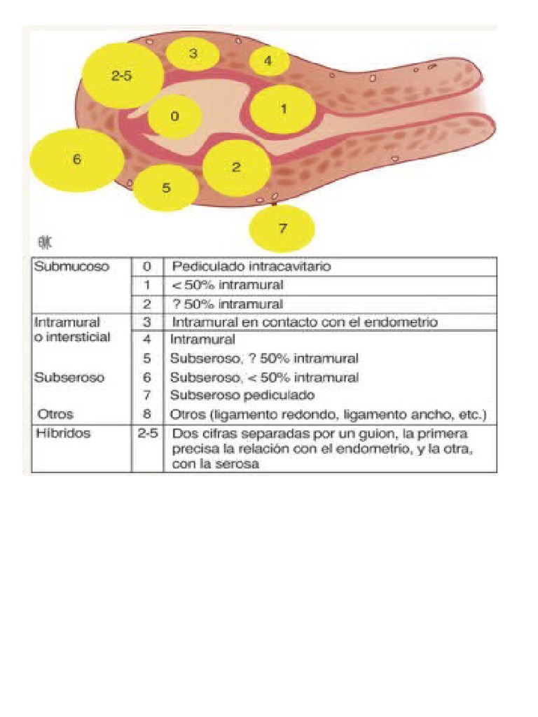 Cuadro Comparatvo de Los Fibromas | PDF