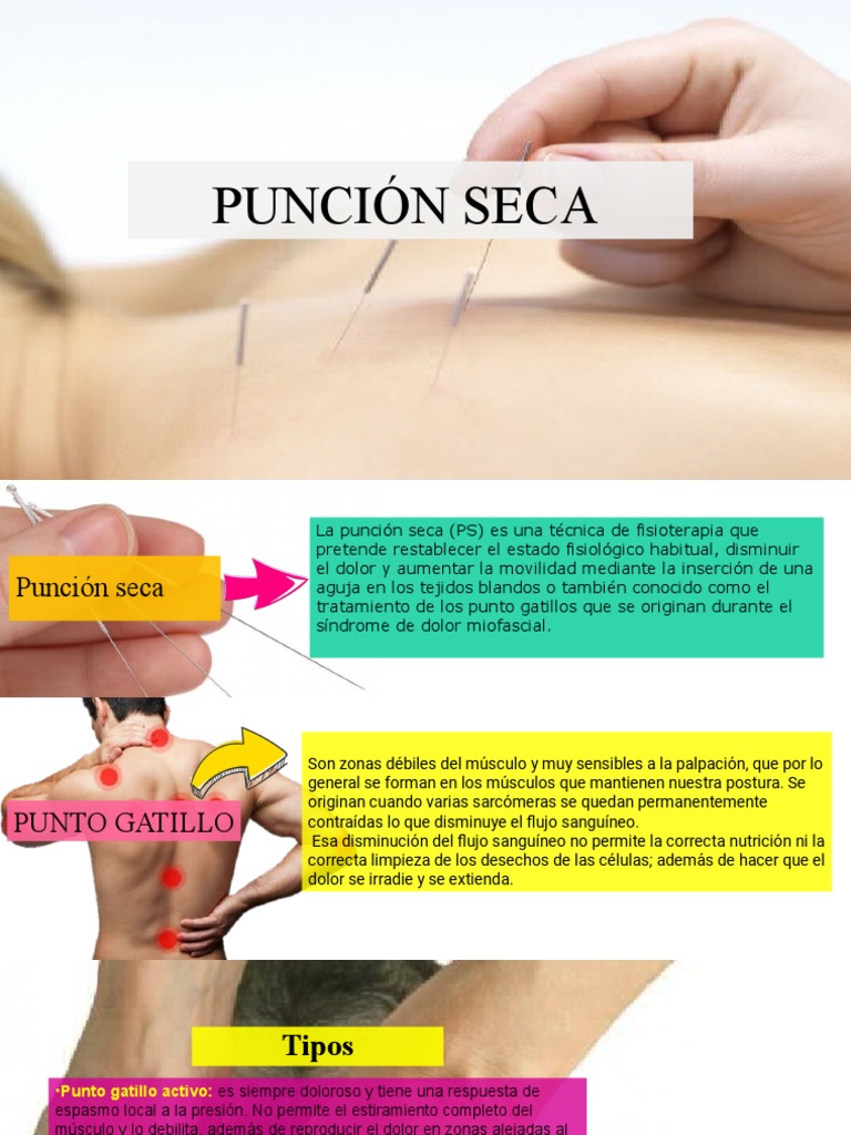Punción Seca | PDF | Dolor | Enfermedades y trastornos