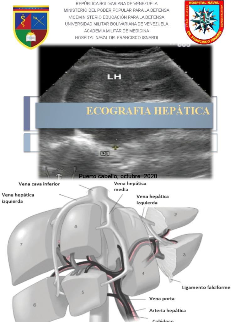 ECOGRAFIA HEPÁTICA | PDF