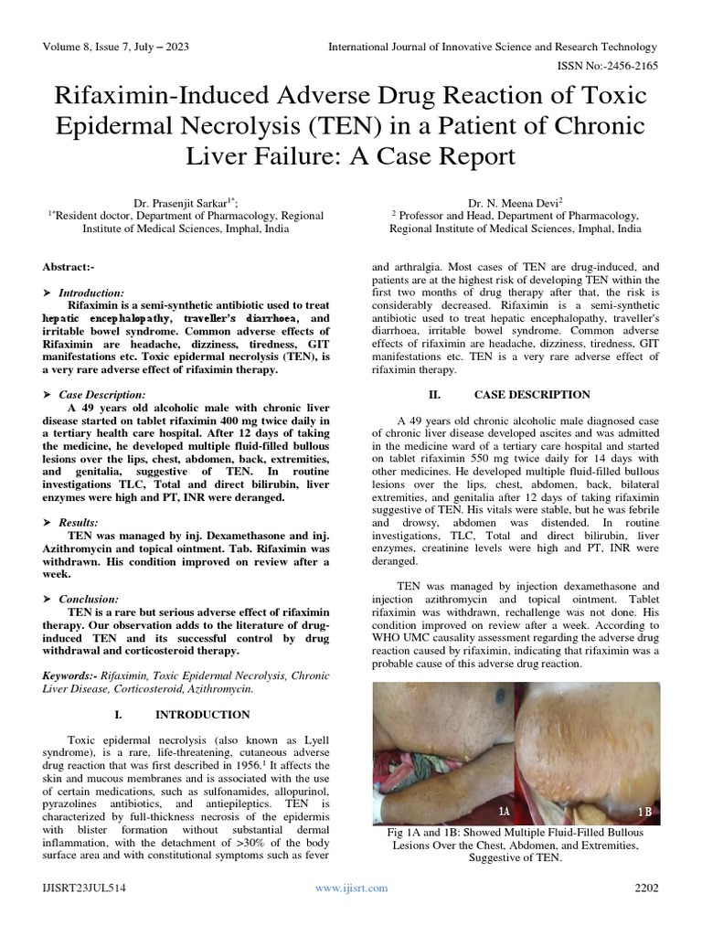 Rifaximin-Induced Adverse Drug Reaction of Toxic Epidermal Necrolysis ...