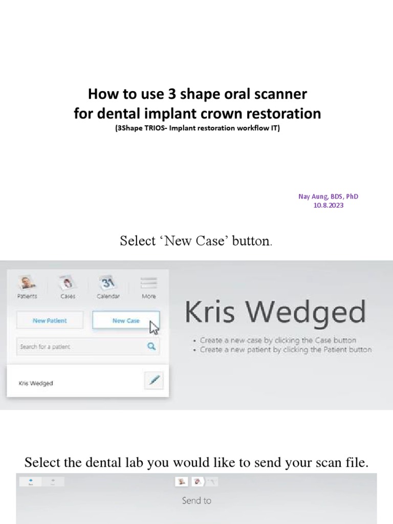 3 Shape Scanner | PDF | Dental Implant | Image Scanner