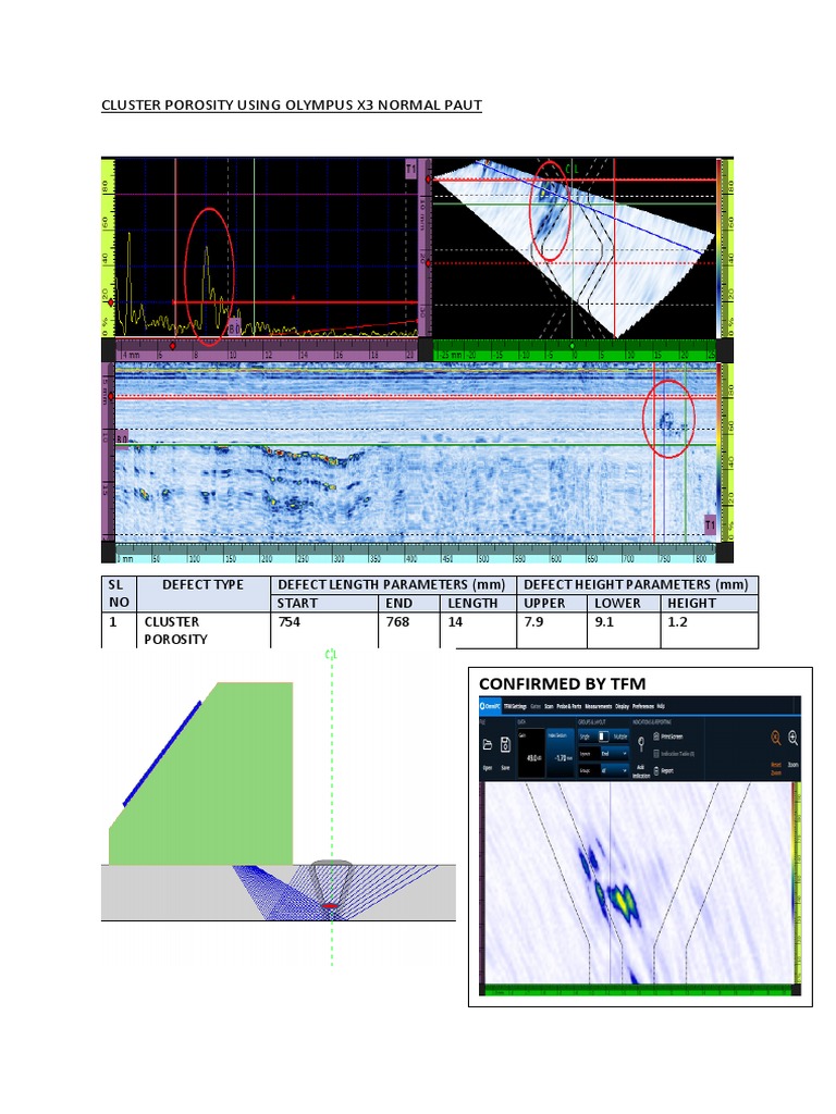 TFM VS Normal Paut | PDF