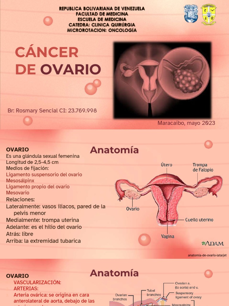 Cancer de Ovario | PDF