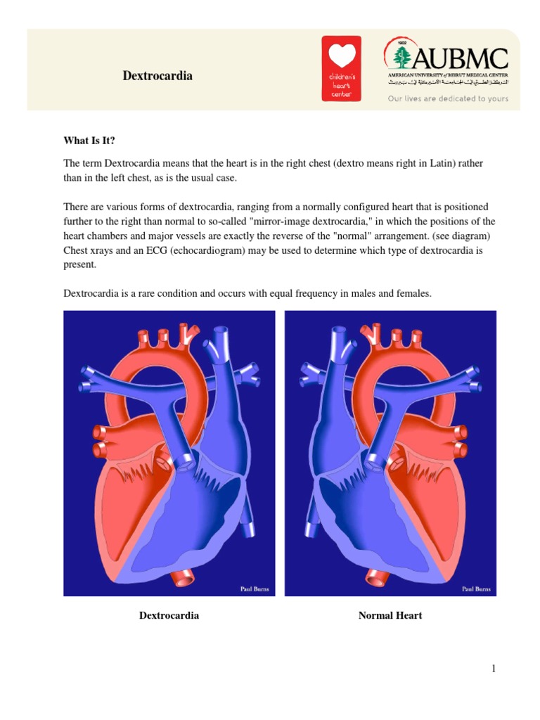 Dextrocardia | PDF