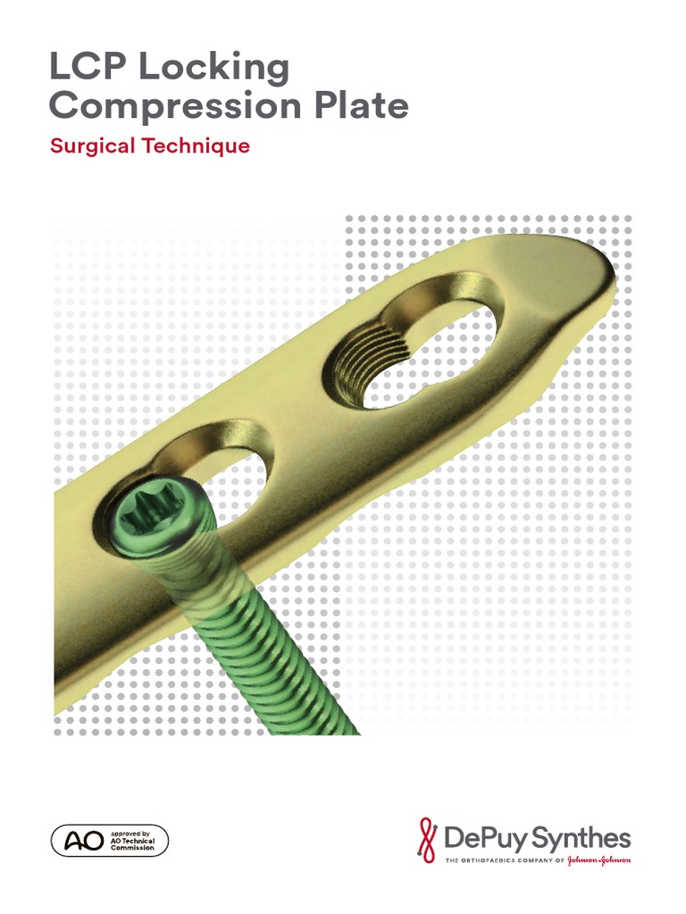 LCP Locking Compression Plate: Surgical Technique | PDF LCP Locking Compression Plate: Surgical Technique | PDF