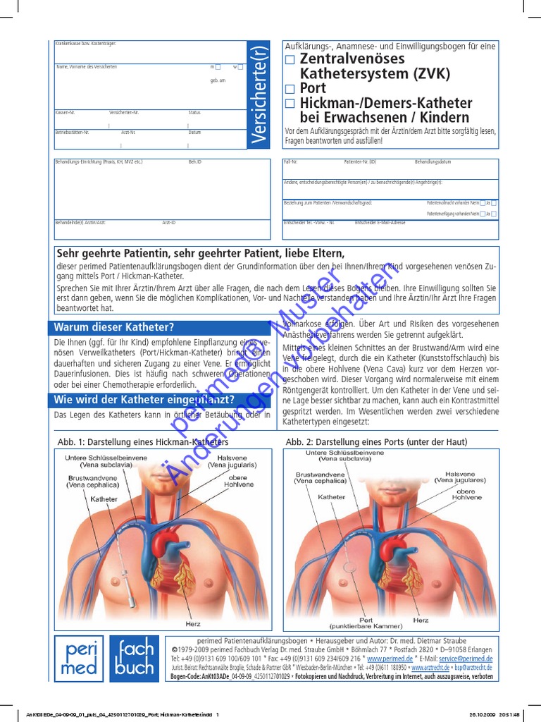 ZVK, Port, Hickman Und Demers Katheter | PDF