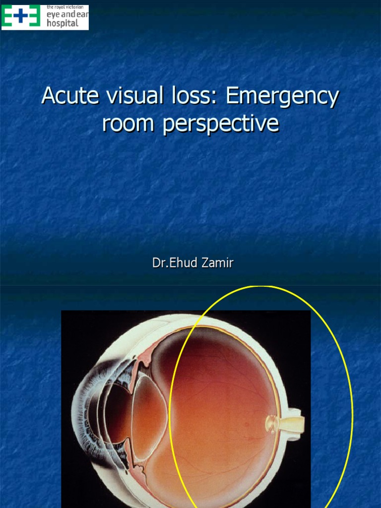 Acute Visual Loss Emergency Room Perspective | PDF