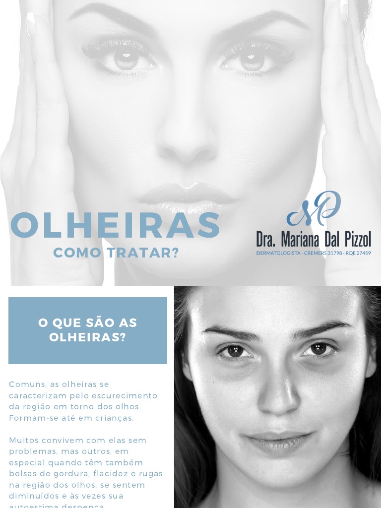 Ebook Olheiras Pdf