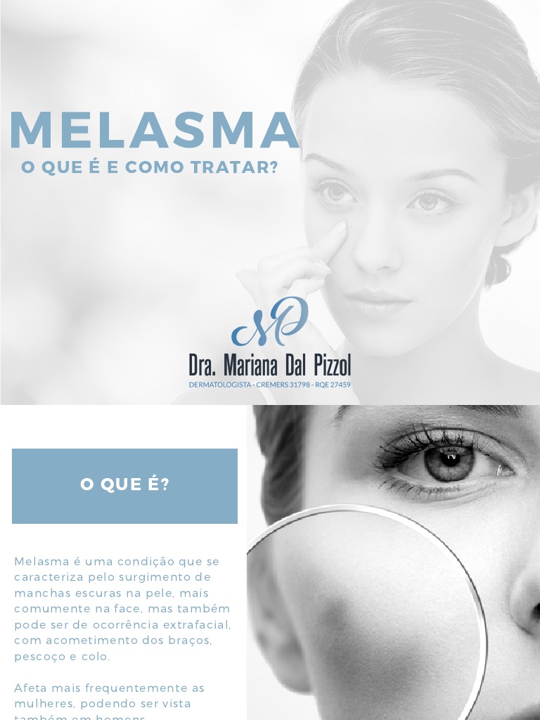 Ebook Melasma | PDF | Ciências e Matemática
