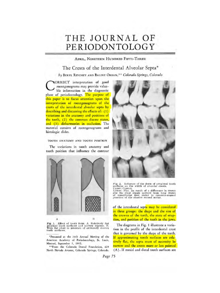 E2-2. Ritchey B, Orban B. The Crests of The Interdental Alveolar Septa ...