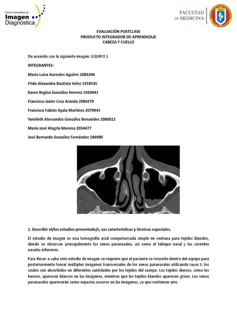 Diagnóstico de Sinusitis Aguda en TAC | PDF | Ct Scan | Epidemiología