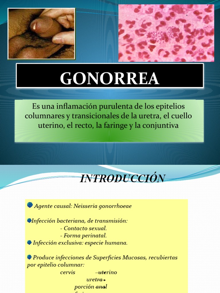 Gonorrea | PDF