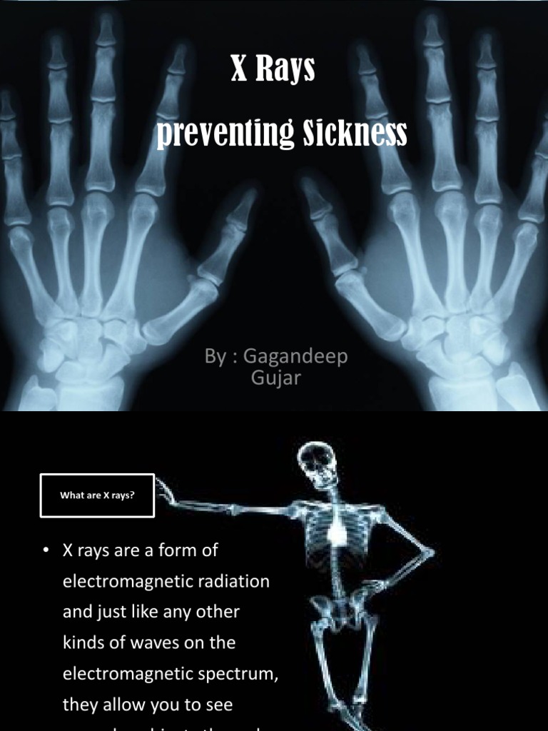 X Rays Preventing Sickness: By: Gagandeep Gujar | PDF | X Ray | Applied ...