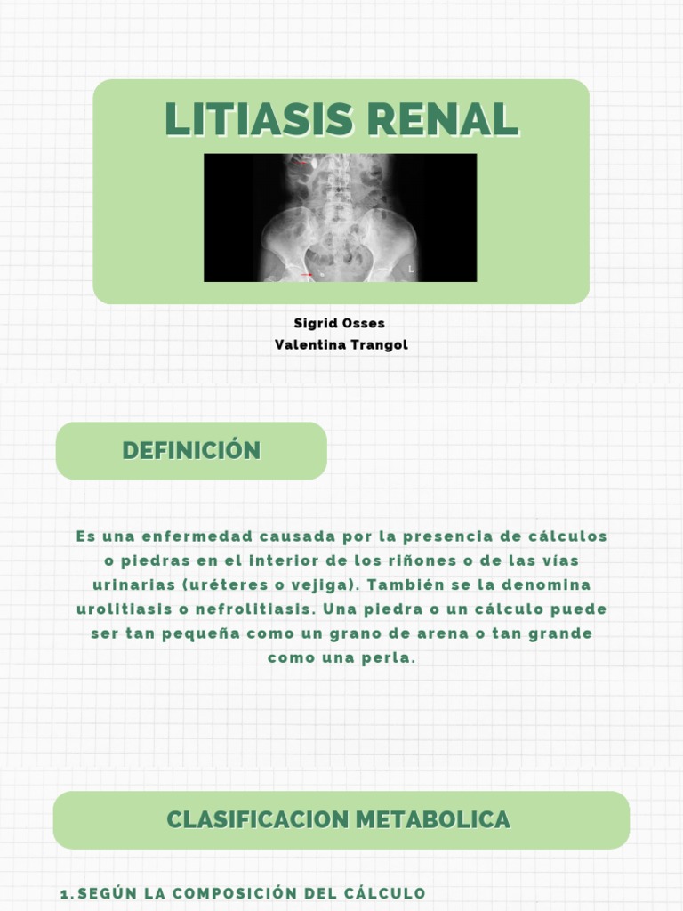 Litiasis Renal | PDF | Especialidades Quirúrgicas | Enfermedades y ...