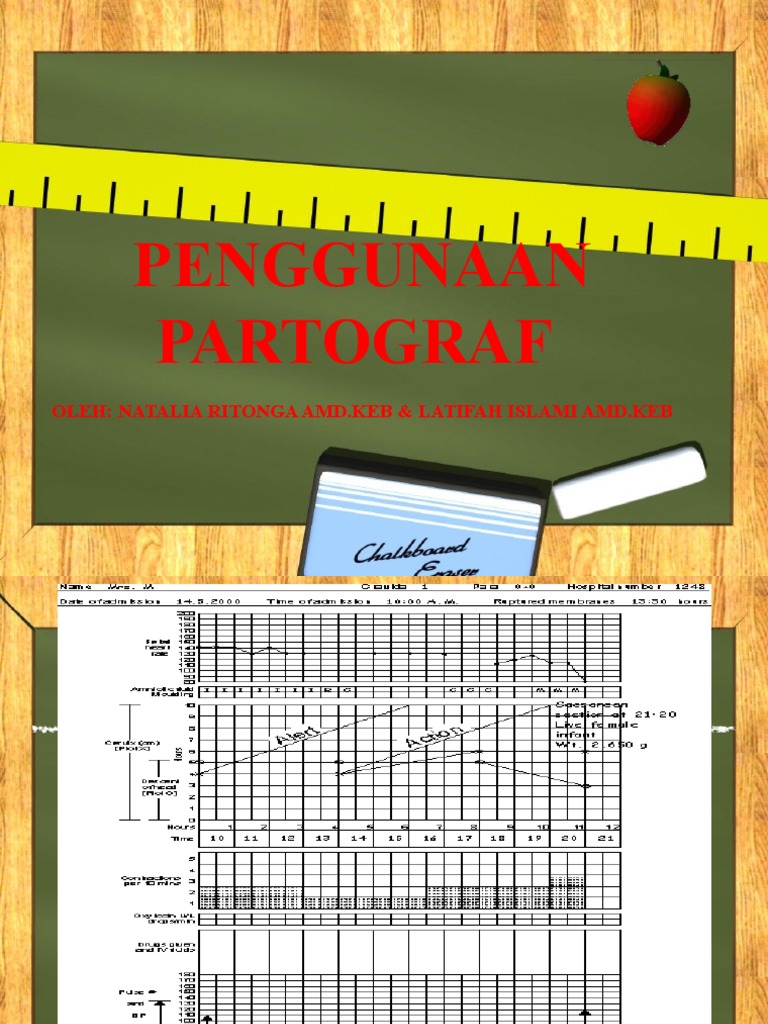 PARTOGRAF - PPT NataliaIIN | PDF