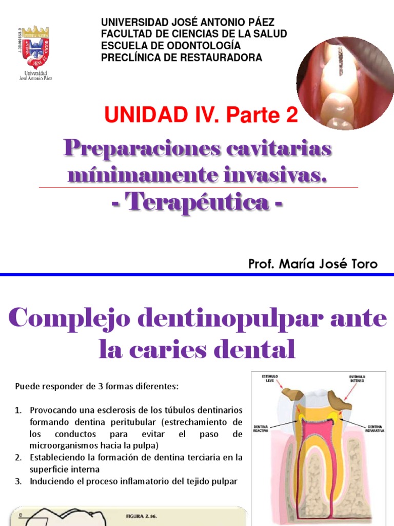UNIDAD IV. Parte 2. Od Maria Jose Toro | PDF | Odontología | Esmalte de ...