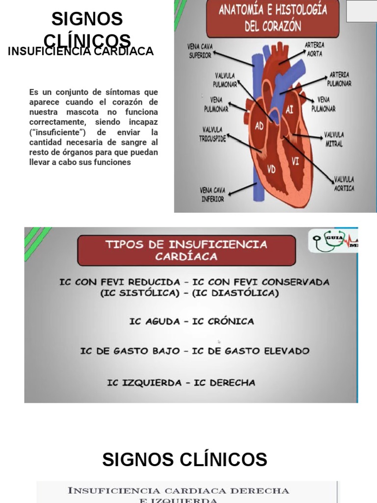 Signos Clinicos Insuficiencia Cardiaca | PDF | Insuficiencia cardíaca ...