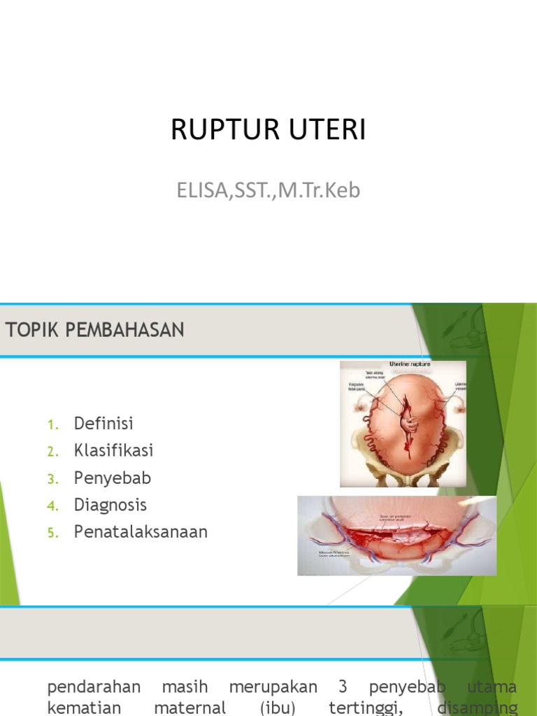 Ruptur Uteri (Ajeng MK Gadar) | PDF