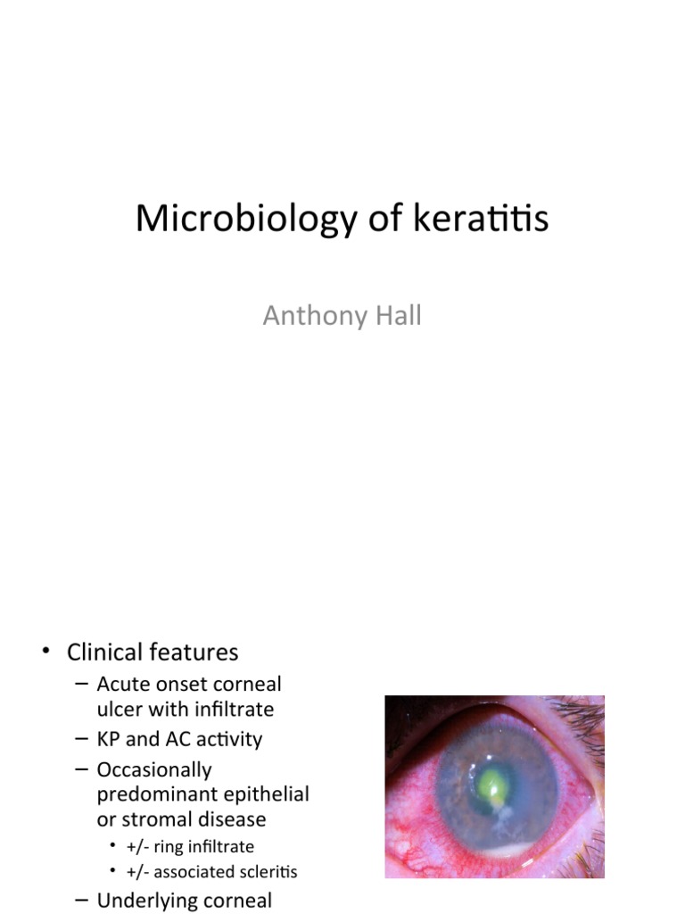 Microbiology of Keratitis | PDF